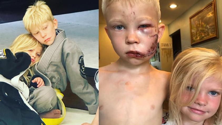 The Heroic Rescue: Boy Who Saved His Sister from a Dog Attack is Saved in Turn – Archyde